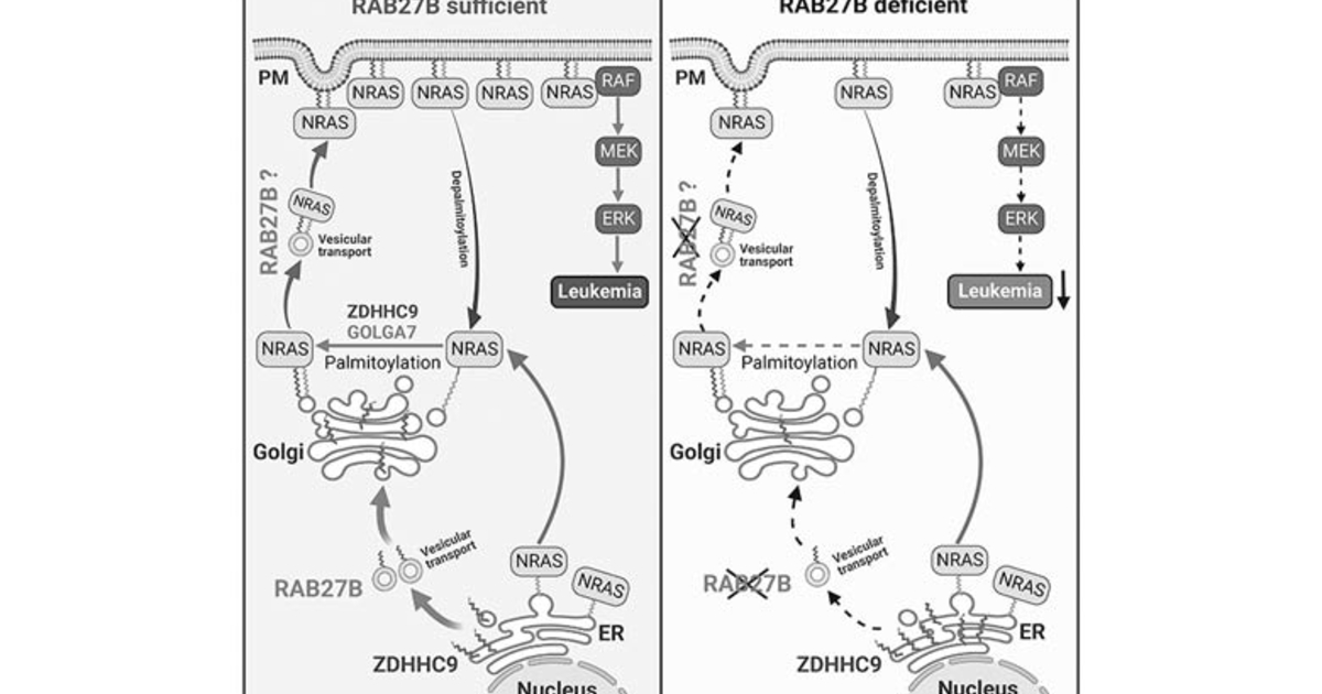 CHOP Researchers Identify Potential Target in Myeloid Malignancies ... CHOP Researchers Identify Potential Target in Myeloid Malignancies ...